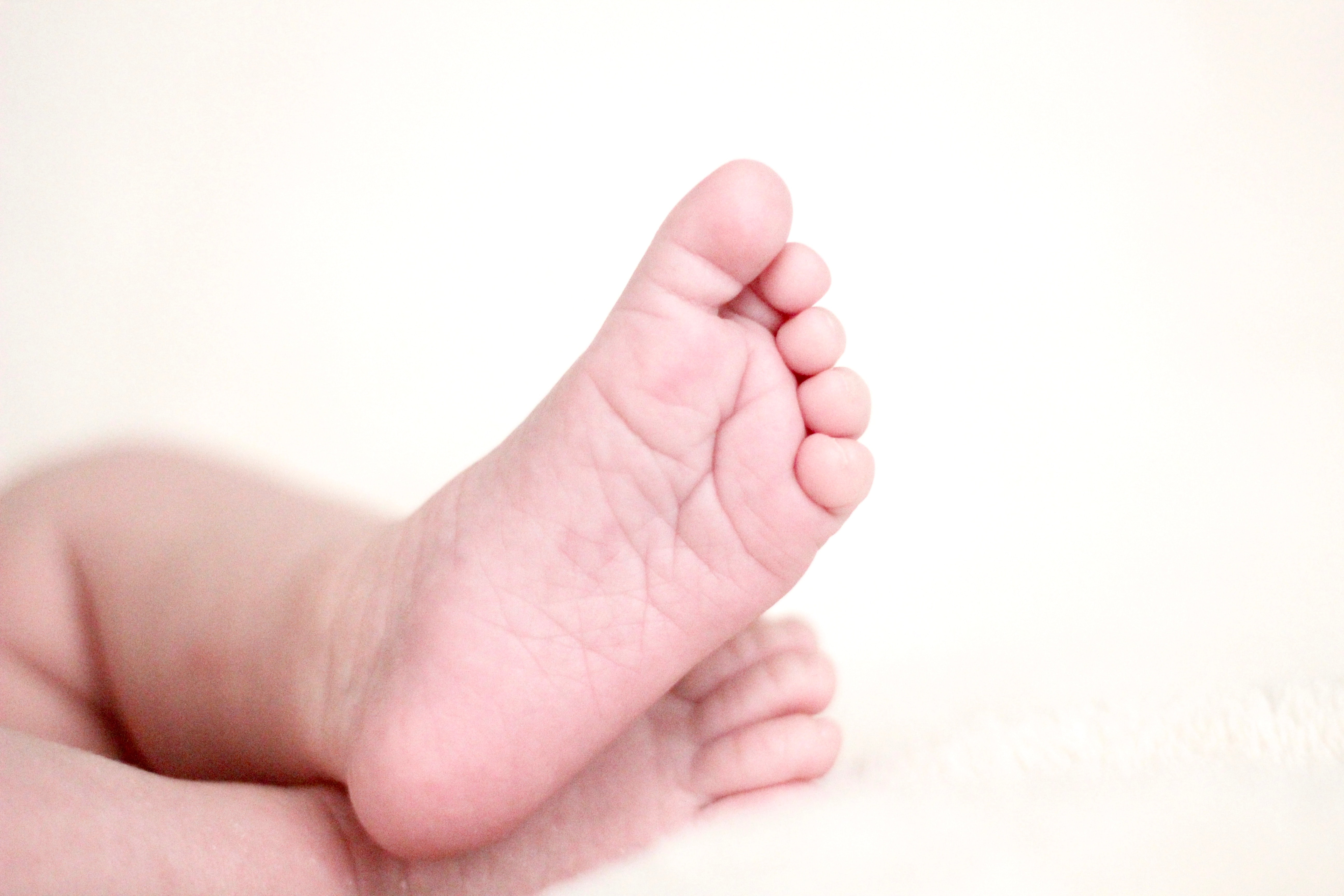 ¿Por qué se hinchan los pies? (causas y recomendaciones) - Guatevision