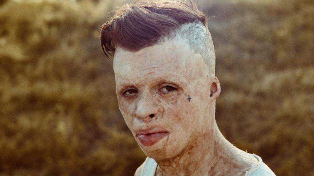 “Tras mi accidente le tengo más miedo a la vida que a la muerte ...